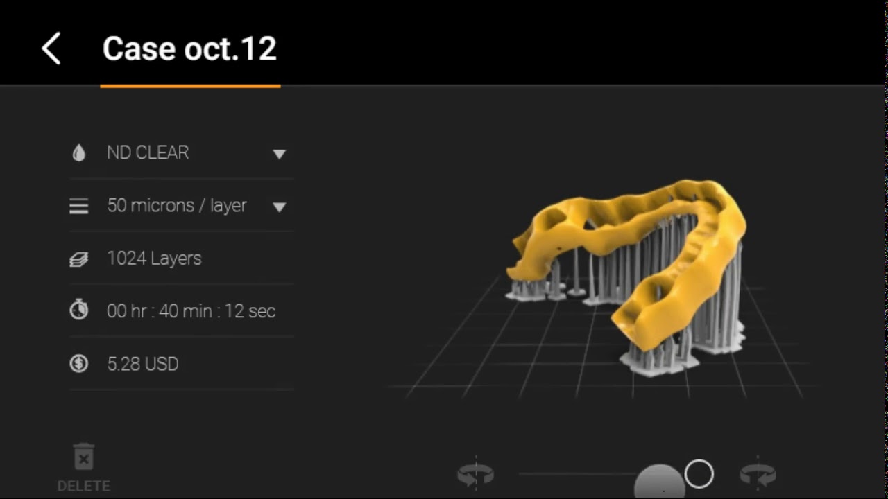 DentCase GUI demo - YouTube