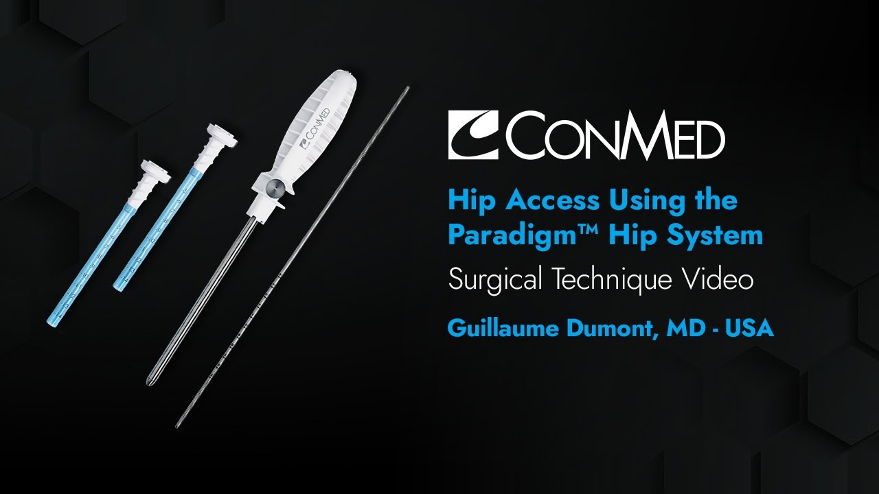 Hip Access Using the Paradigm™ Hip System - Guillaume Dumont, MD ...