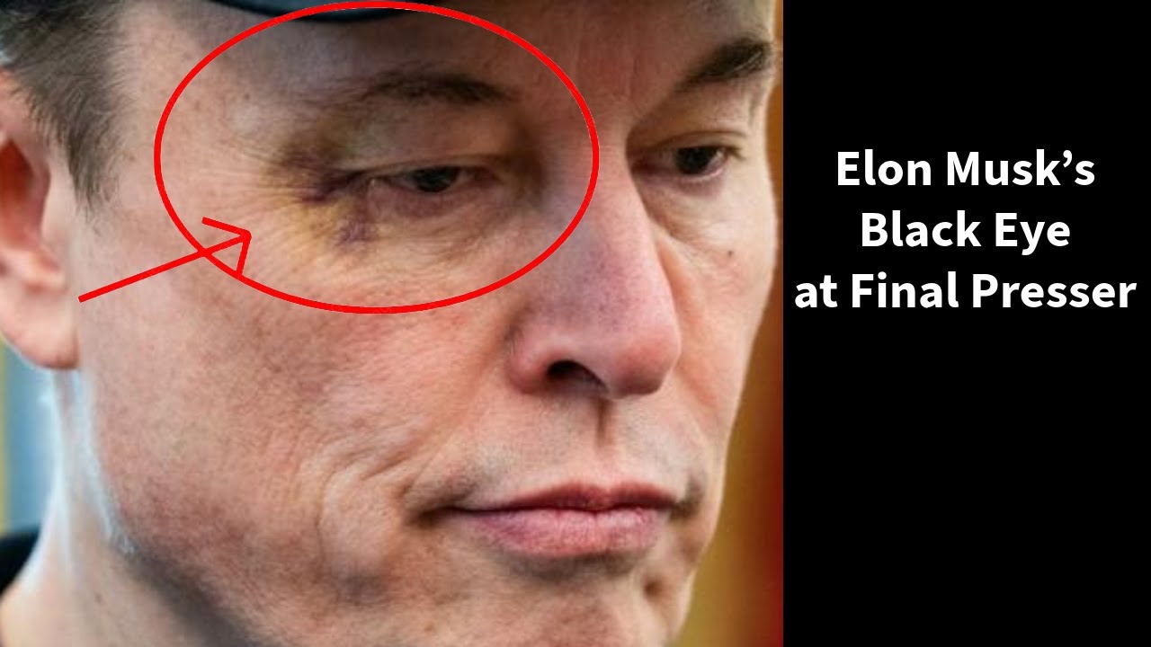 Elon Musk’s Black Eye at Final Presser - YouTube
