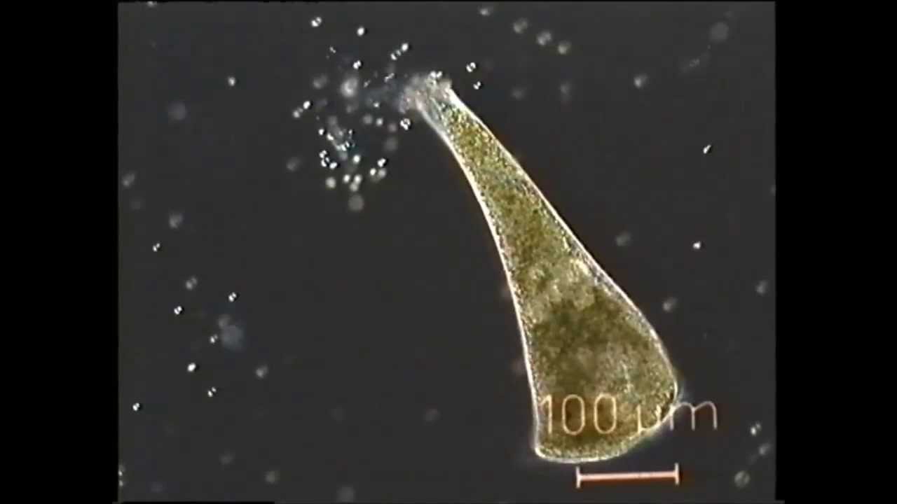 Stentor, a large heterotrich ciliate - YouTube