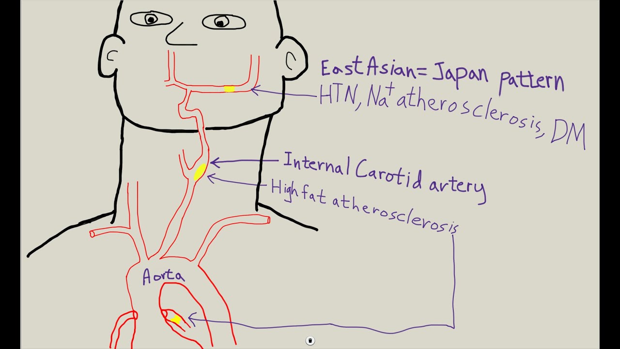 What thickens the blood? Diet approach to CHF, congestive heart failure ...