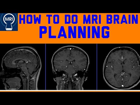 How to do MRI brain. MRI brain planing. MRI Brain position.Mri brain ...