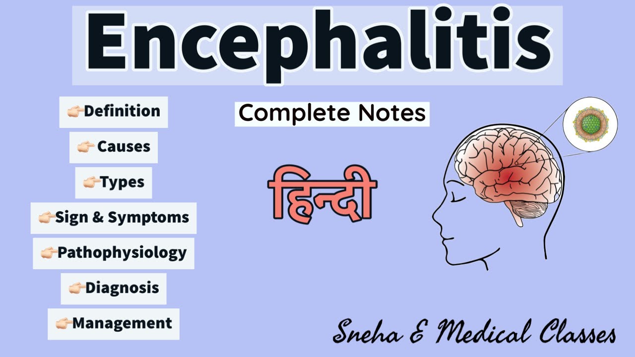 Encephalitis !! Causes !! Sign & Symptoms !! Diagnosis ...