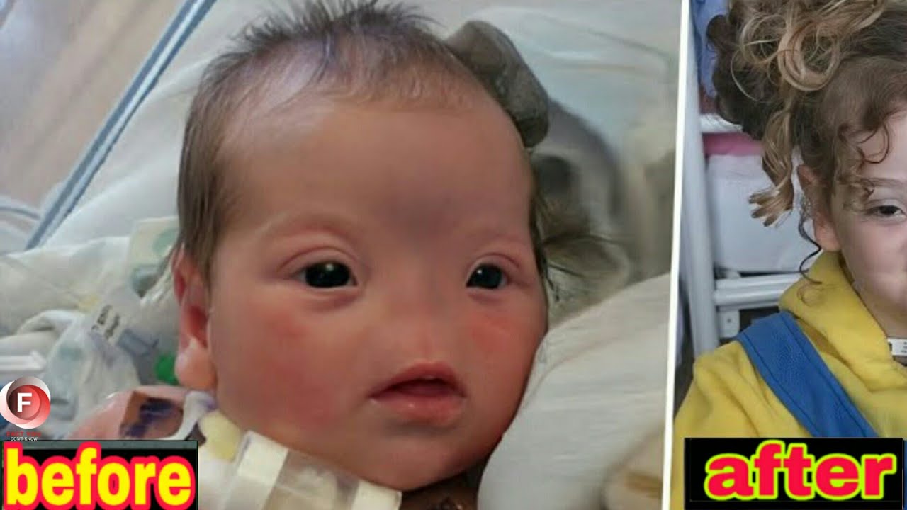 He was abandoned for being without nose What he Did Then Is Hard to ...