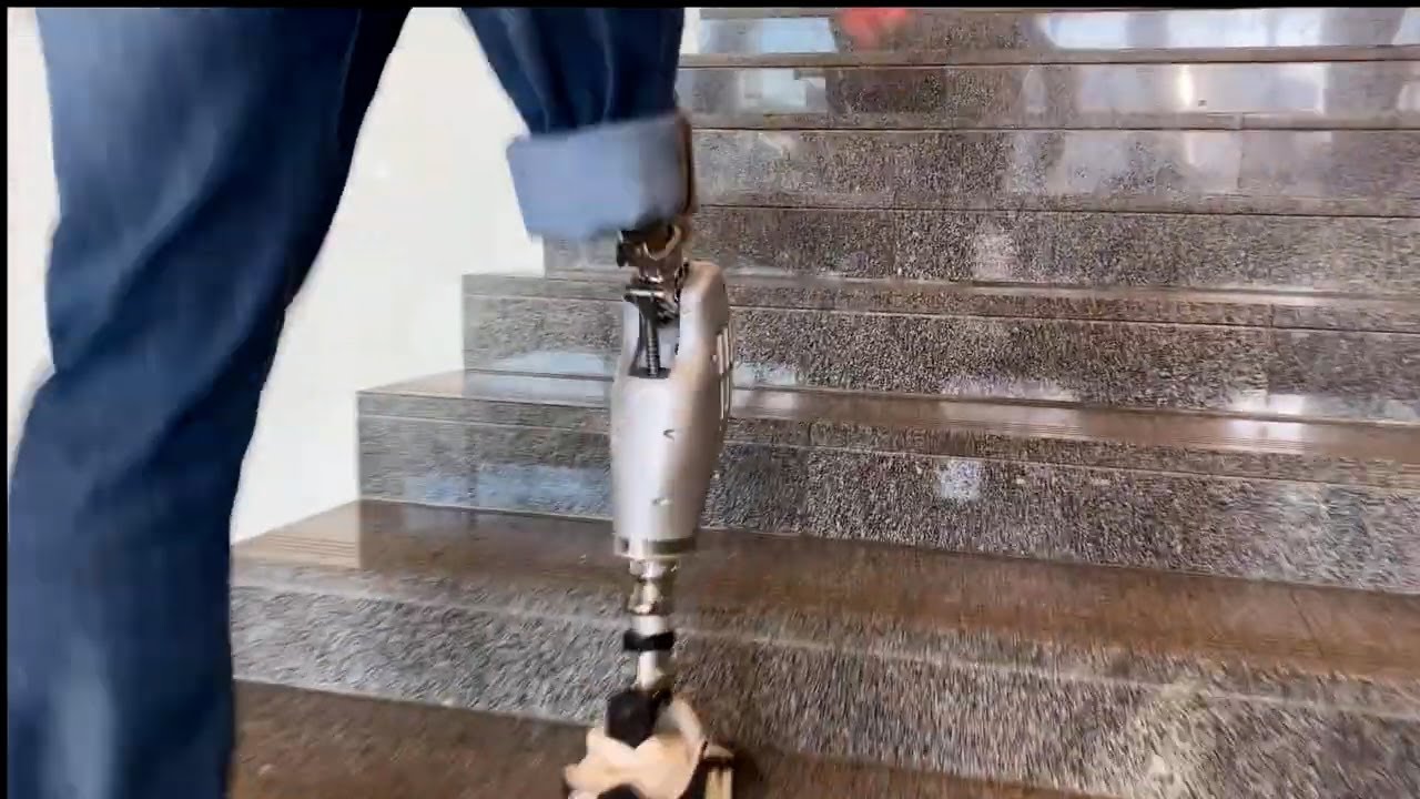 Протез ноги с микропроцессорной коленкой “Intuy Knee” - действительно ...