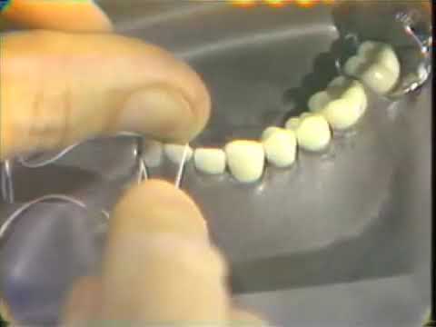 Rubber Dam Placement on the Visidont - YouTube