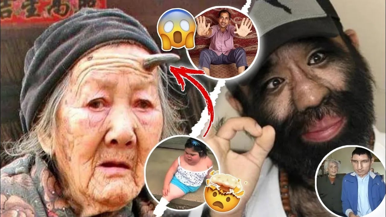 10 PERSONAS Que Son Un CAPRICHO de la NATURALEZA 😨 - YouTube