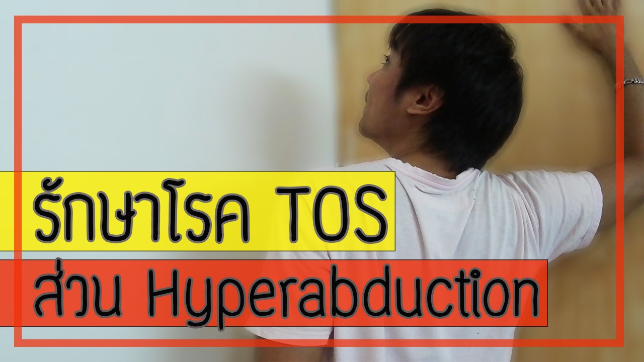 [คลิป 19] รักษาโรค TOS ส่วน Hyperabduction syndrome กับอาการปวดคอก็ ...