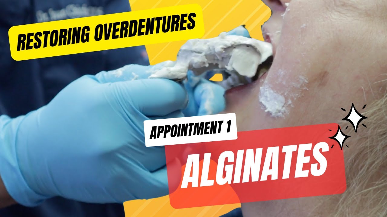 Restoring Implant Overdentures: Alginate Impressions - YouTube