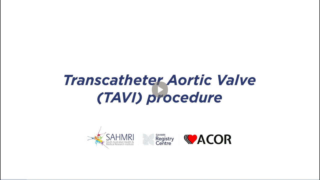 Understanding the Transcatheter Aortic Valve Implantation (TAVI ...