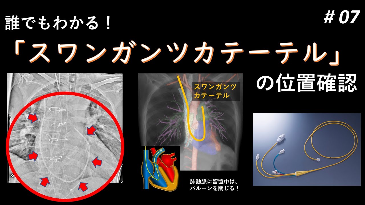 #07 誰でもわかる！スワンガンツカテーテルの位置確認 - YouTube