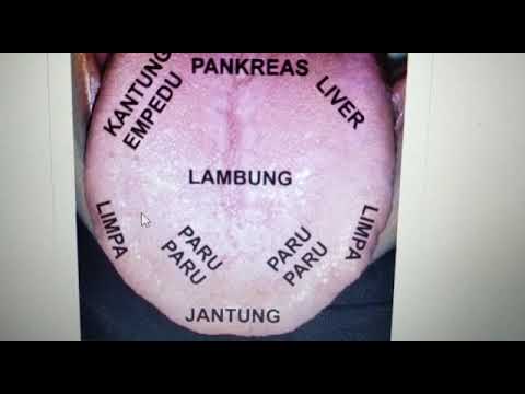 Diagnosa lidah sederhana oleh sifu octra - YouTube