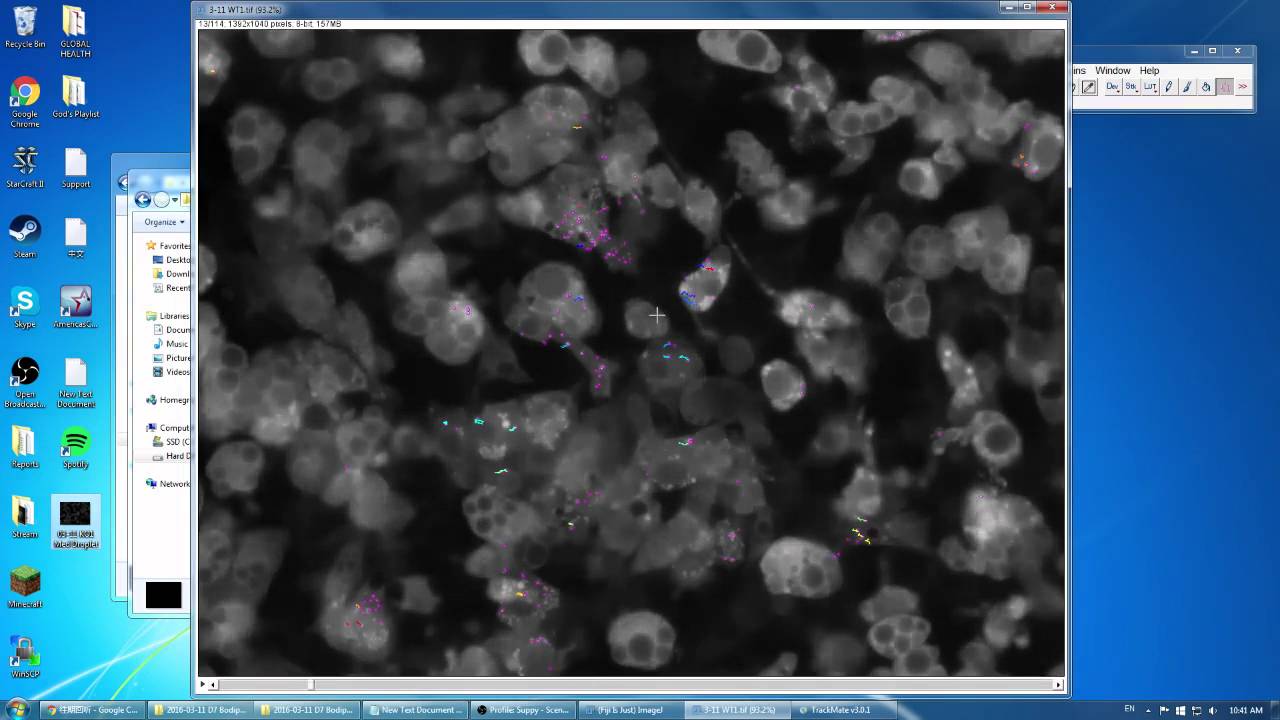 ImageJ Trackmate Moving Lipid Droplet Tracking - DoG Detector - YouTube