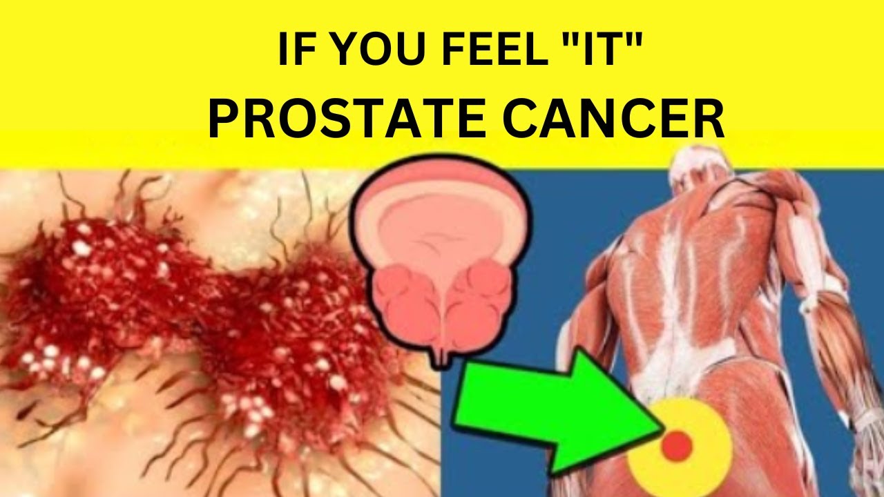 PROSTATE CANCER : Early Signs and symptoms Don't Ignore! - YouTube