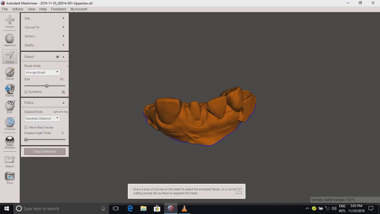 Meshmixer 3D printed dental crown part 1 - YouTube