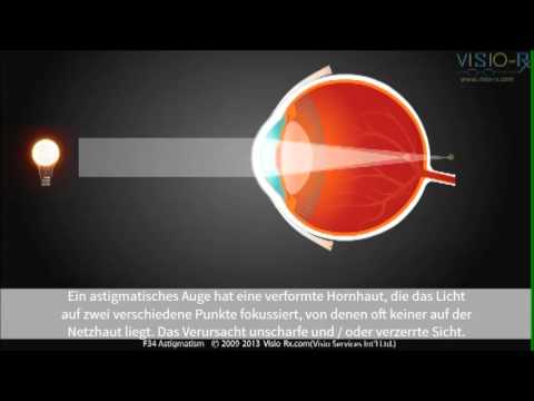 Was versteht man unter Astigmatismus? - YouTube