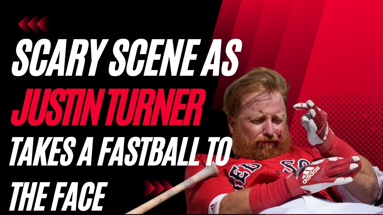 Justin Turner gets hit in the face with a fastball - YouTube