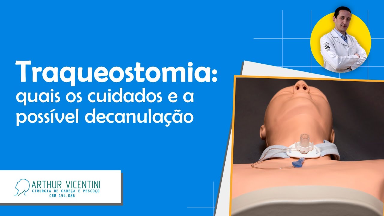 Traqueostomia: quais os cuidados e a possível decanulação | Dr. Arthur ...