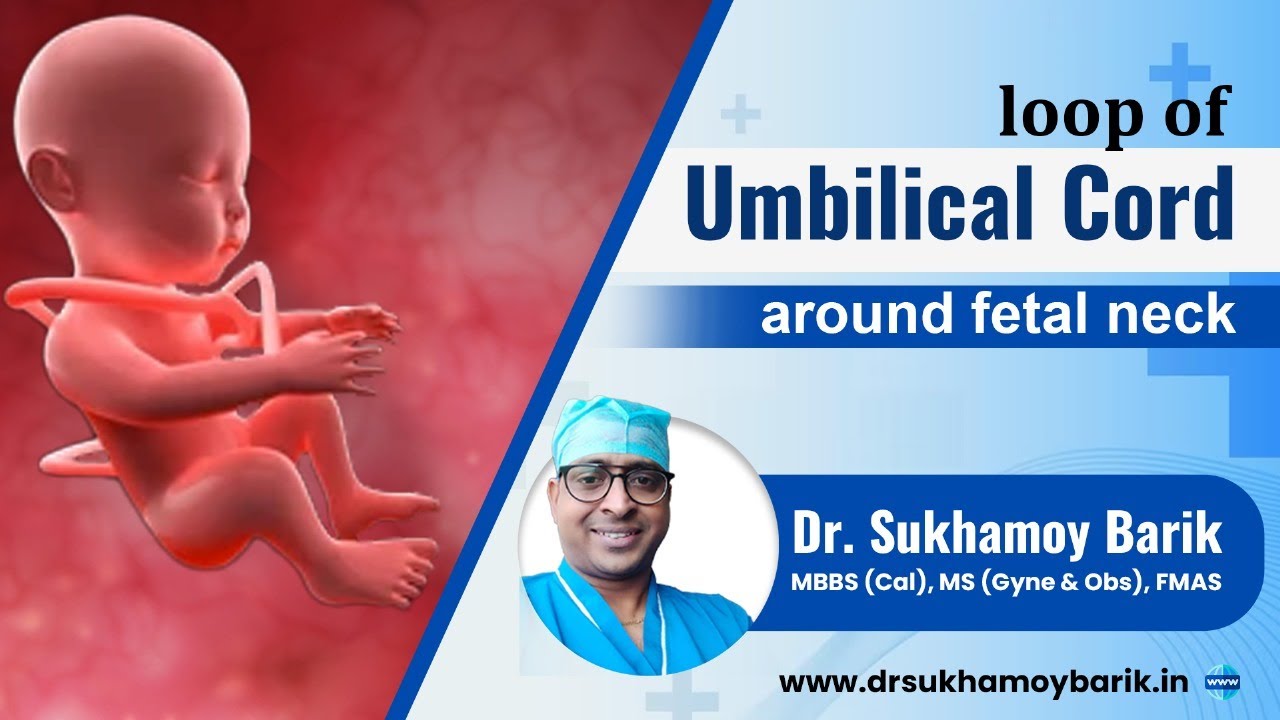 What is a loop of Cord around the neck? | Dr. Sukhamoy Barik ...