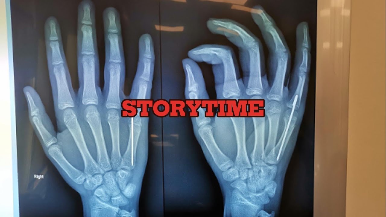 ΕΣΠΑΣΑ ΤΟ ΧΕΡΙ ΜΟΥ (STORYTIME) - YouTube