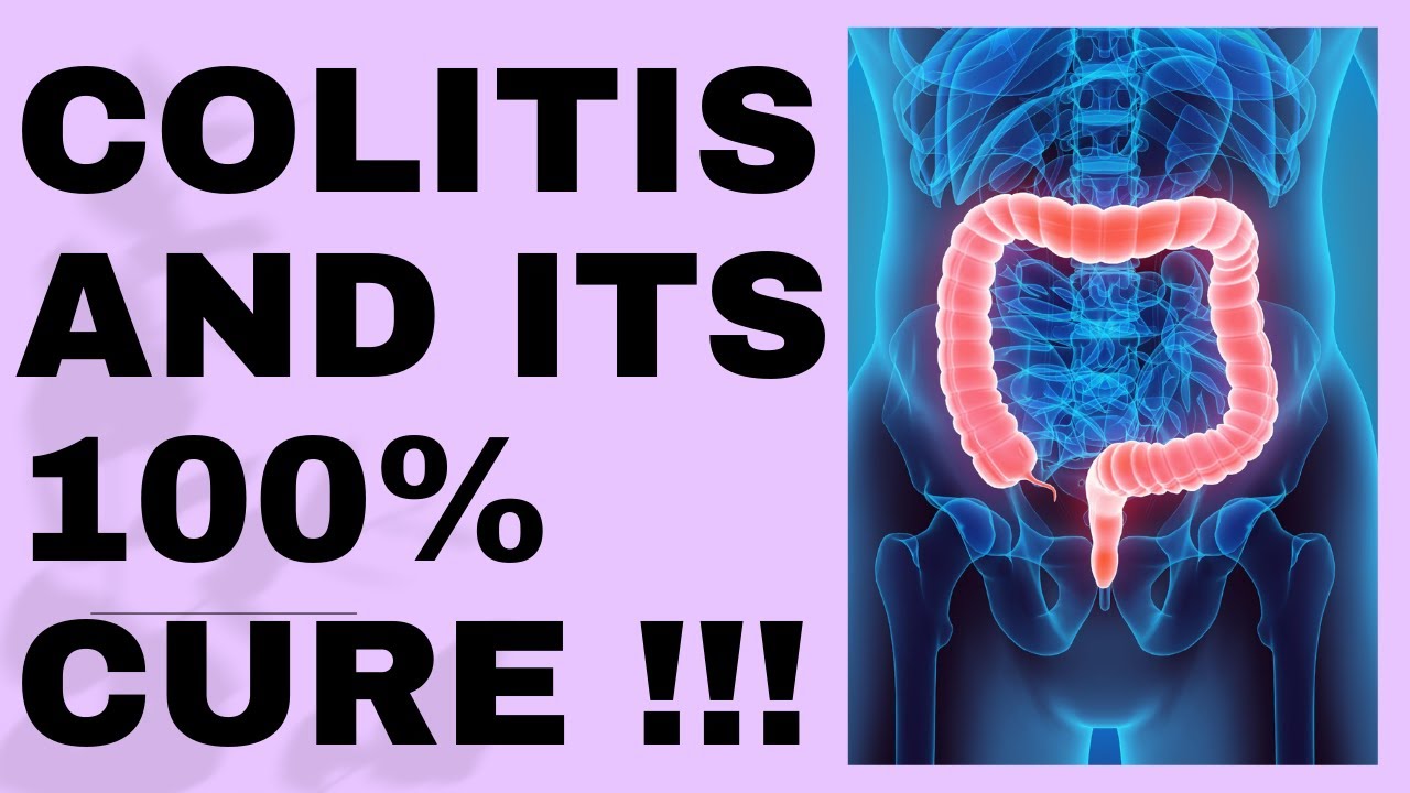 colitis||homeopathy medicine for colitis in hindi||ulcerative colitis ...