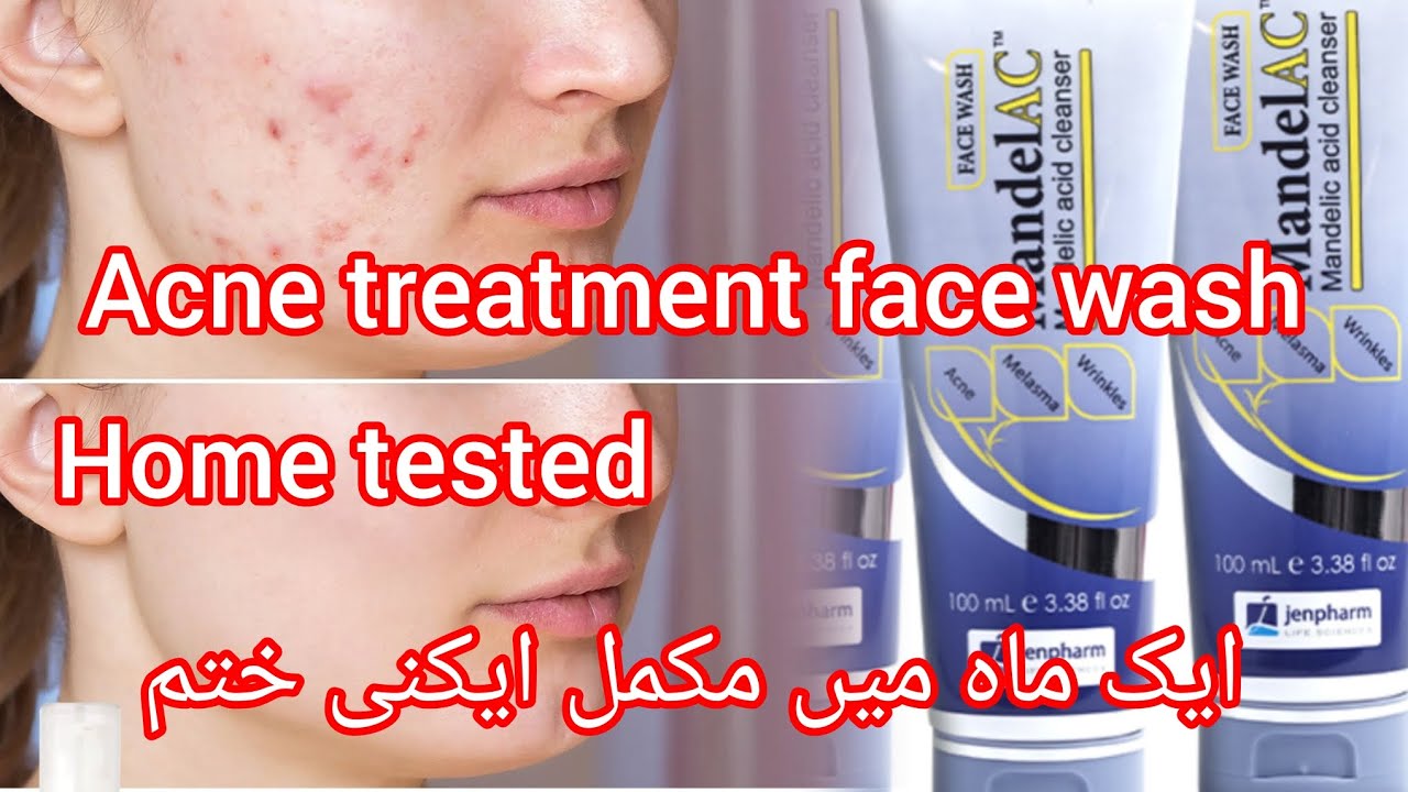Jenpharm Mandelic acid face wash| Face wash for acne skin|acne treament ...