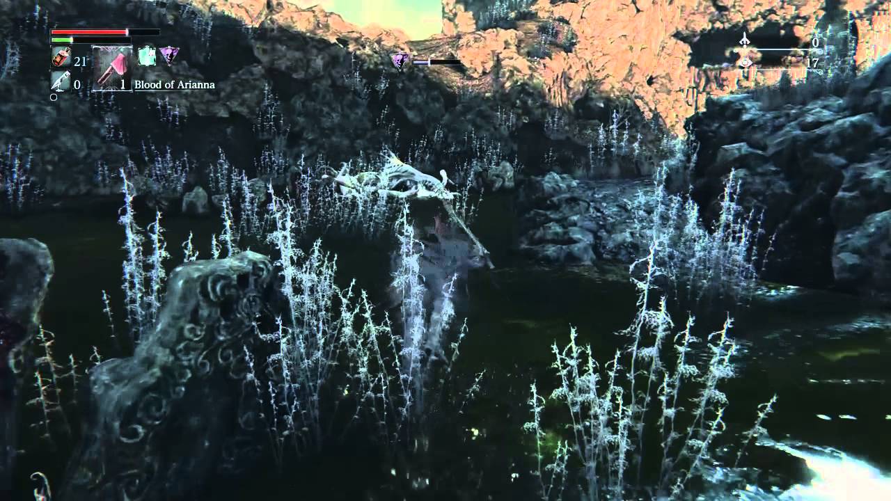 Bloodborne™ The Nightmare Frontier Easy way down - YouTube