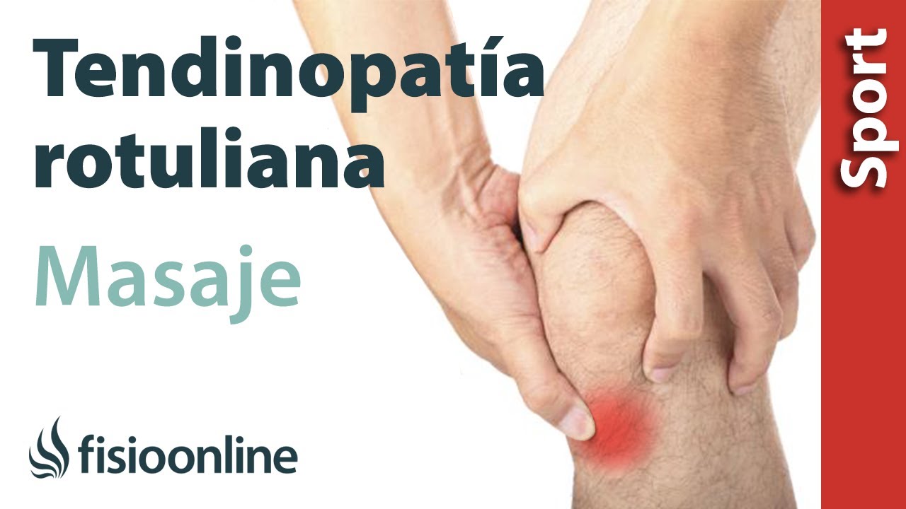 CÓMO hacer un masaje para la TENDINOPATIA ROTULIANA en deportistas ...