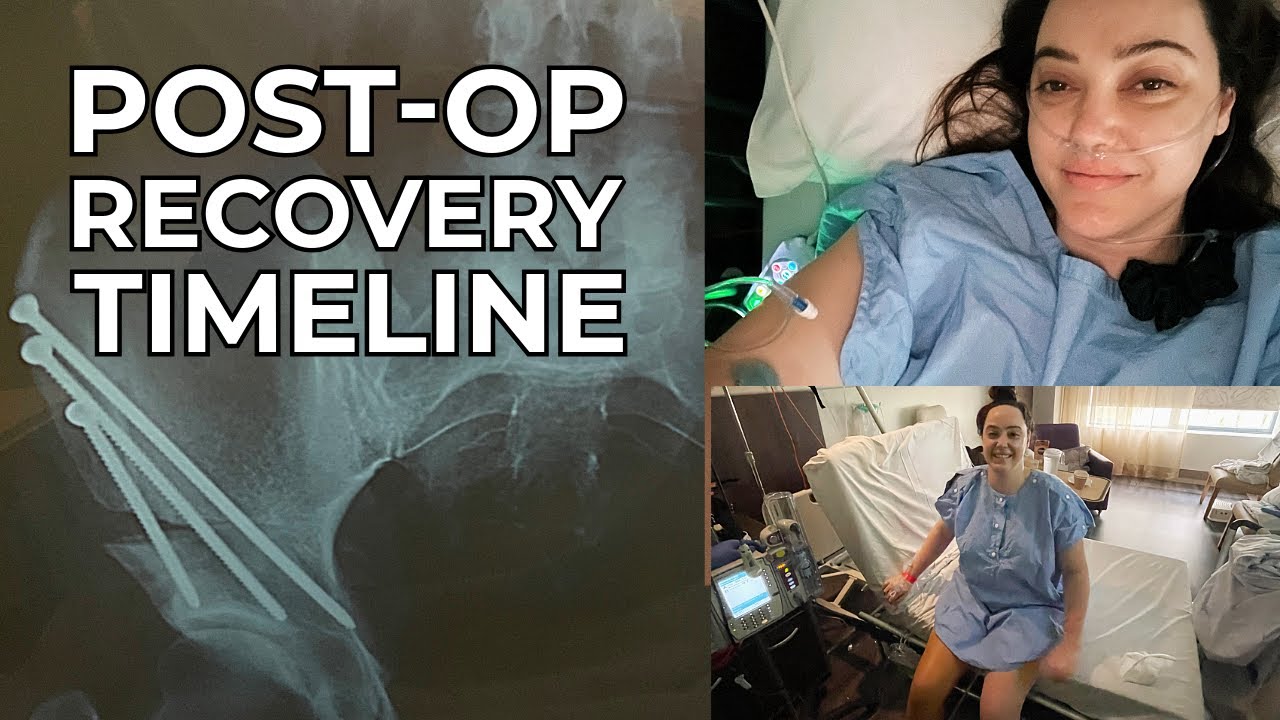 My PAO surgery experience (from hospital to 6 months post op) + ALL MY ...