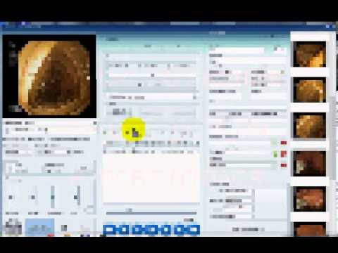 Software for Endoscopy - YouTube
