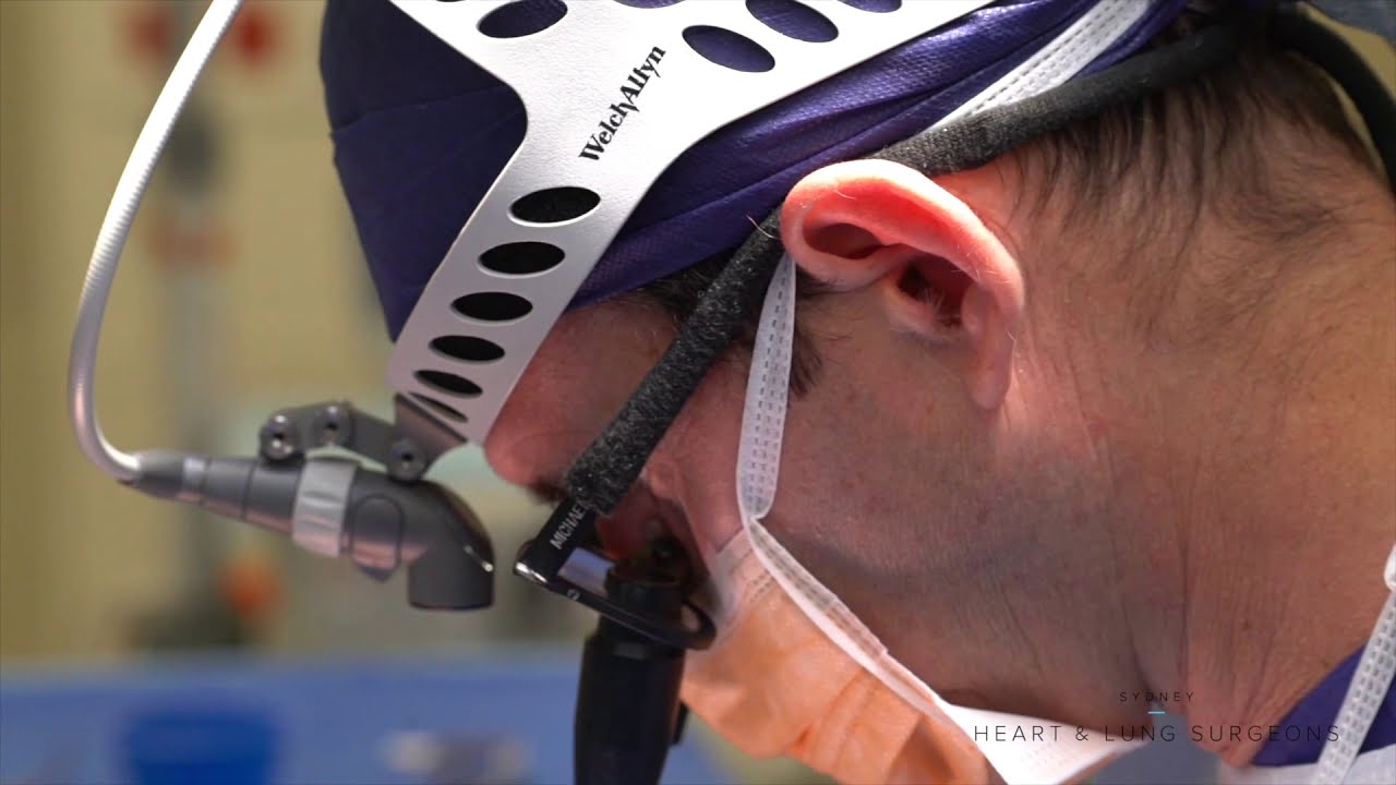 Anaortic, Off-Pump CABG - Summary - YouTube