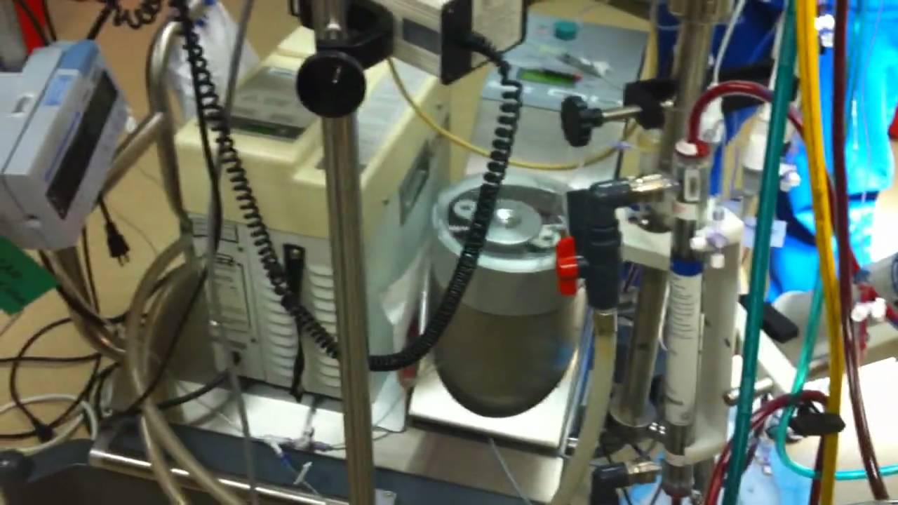 ECMO! - YouTube