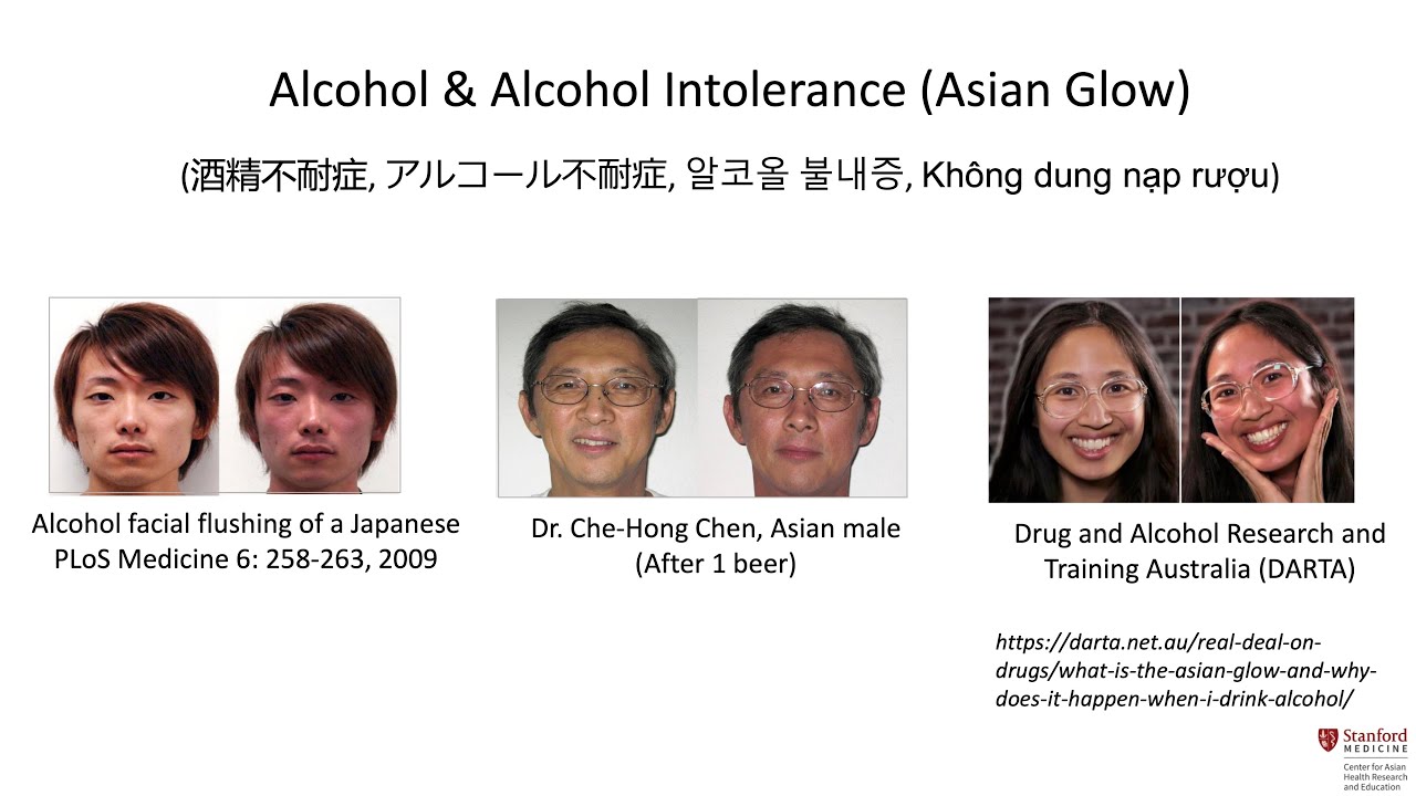 Asian Glow & Cancer Risk: Asian Alcohol Intolerance and Health - What ...
