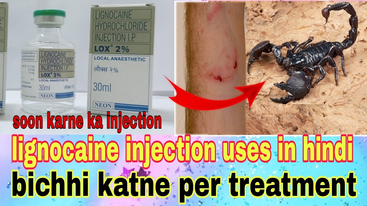 lignocaine injection uses in hindi / lignocaine injection | soon karne ...