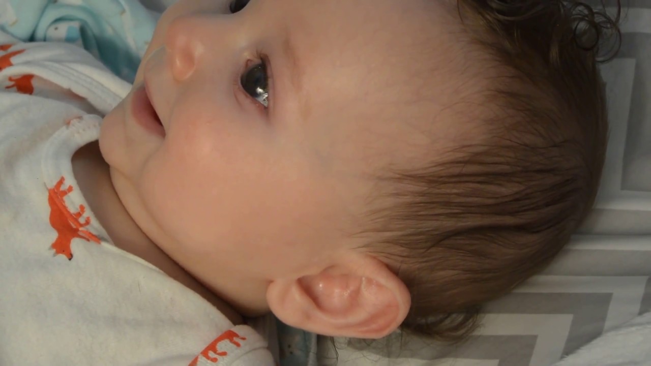 Contact Lens Removal from a baby with explanation - YouTube