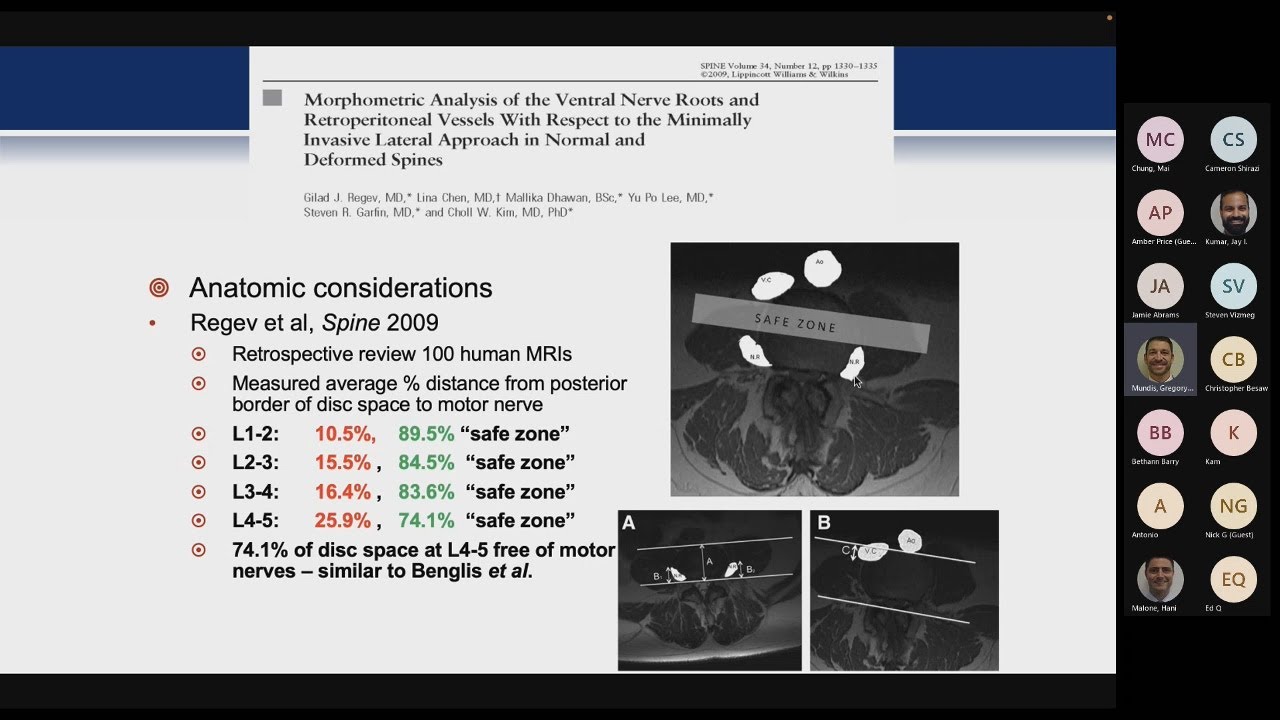 LLIF Technique presented by Gregory M. Mundis, Jr., MD : San Diego ...