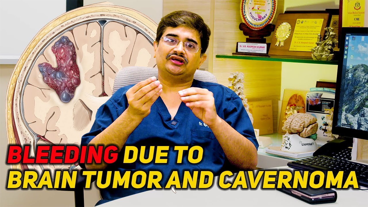 Bleeding due to Brain Tumor and Cavernoma: Understanding the Causes and ...
