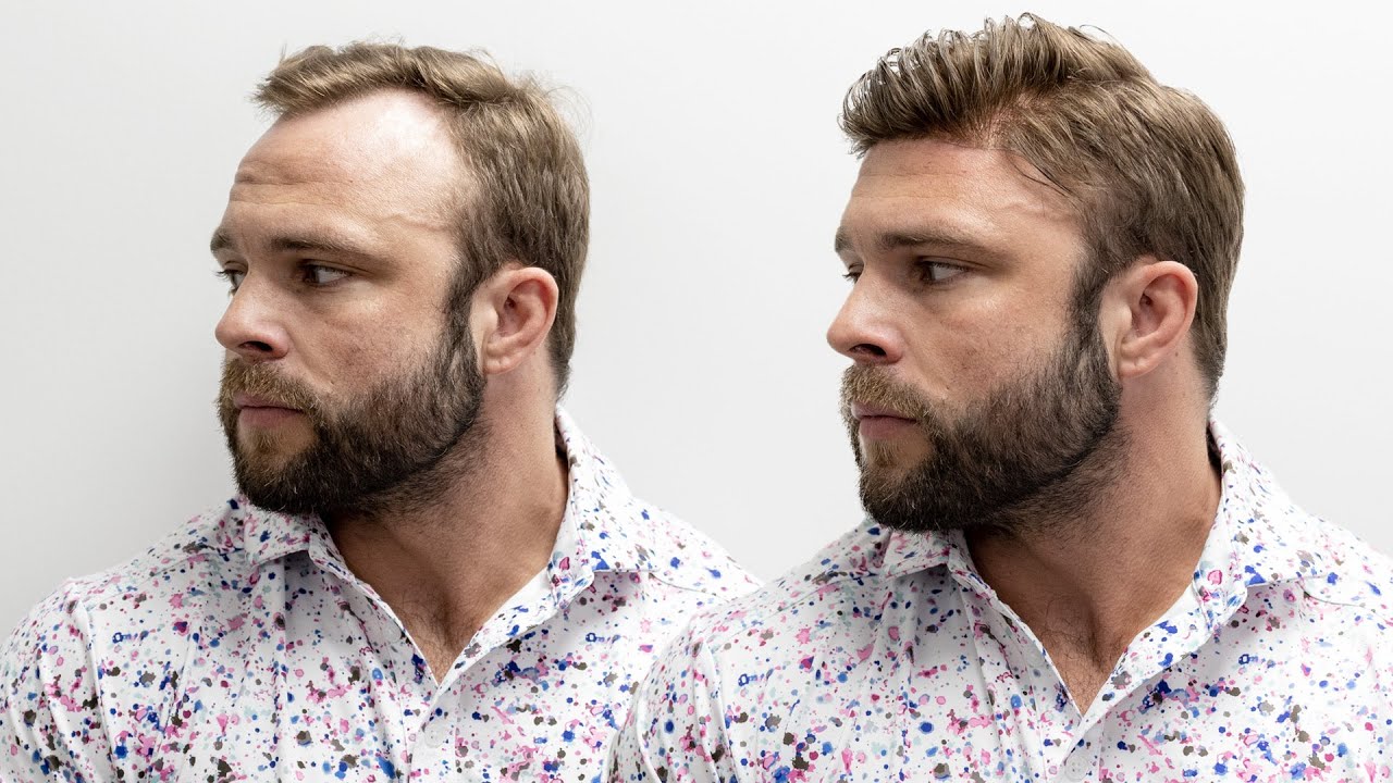 INCREDIBLE front hairline transformation! | Installing and styling a ...