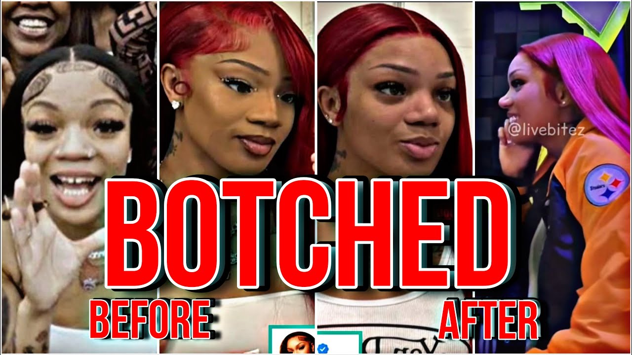 Glorilla Gets A New Nose Job & Messed Up Her Whole Face!? She’s Botched ...
