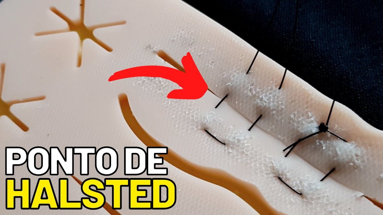 Como fazer um PONTO de HALSTED? Sutura fio Nylon PASSO A PASSO PONTO ...