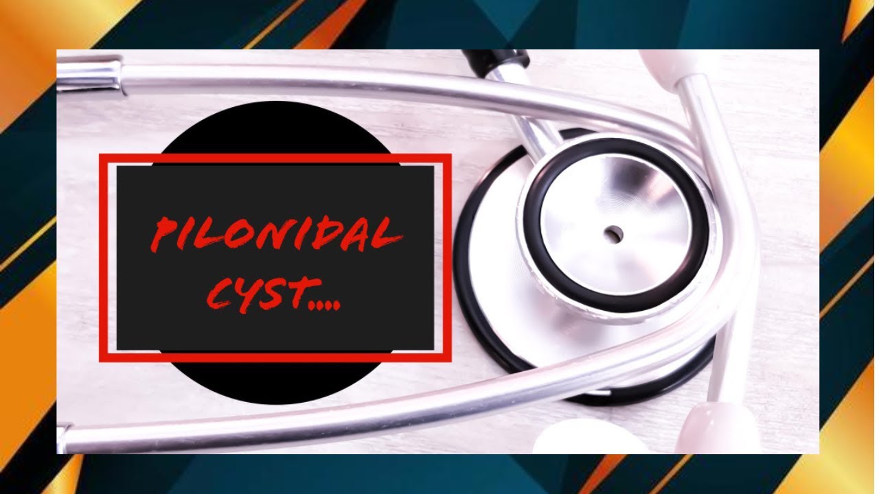 Pilonidal Cystectomy | Sinus | Abscess | Pilus =nidus (nest of hair ...