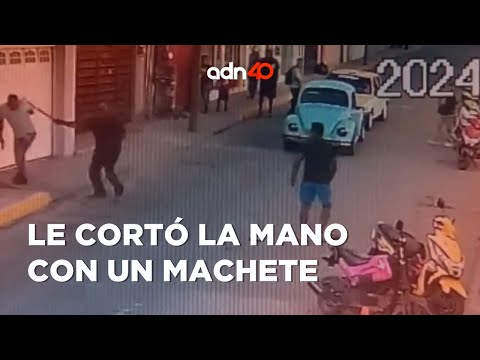 Atacan a machetazos a un elemento de la Guardia Nacional