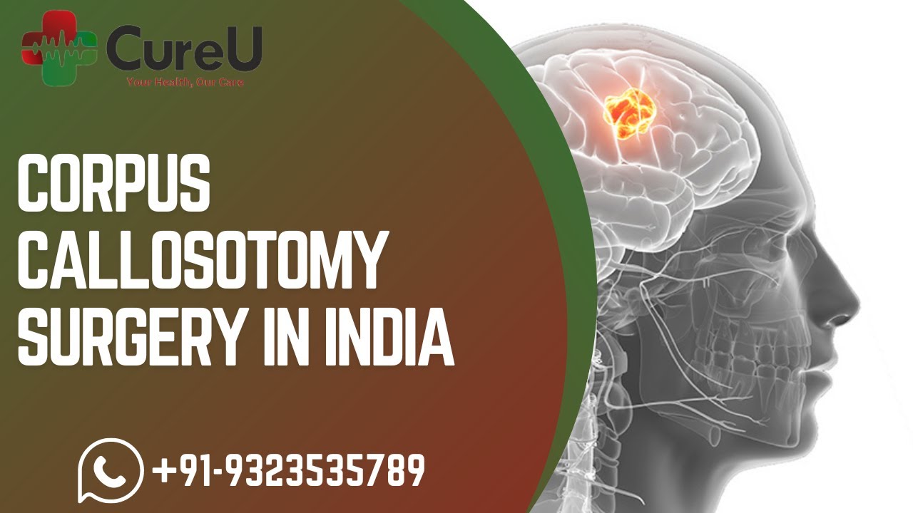 Life-Changing Corpus Callosotomy Surgery in India | Everything You Need ...