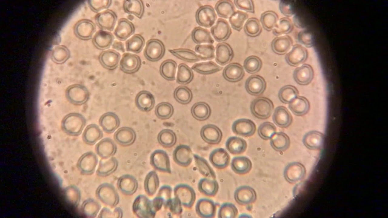 These are the funky boat cells I keep seeing.... uggh what are these ...