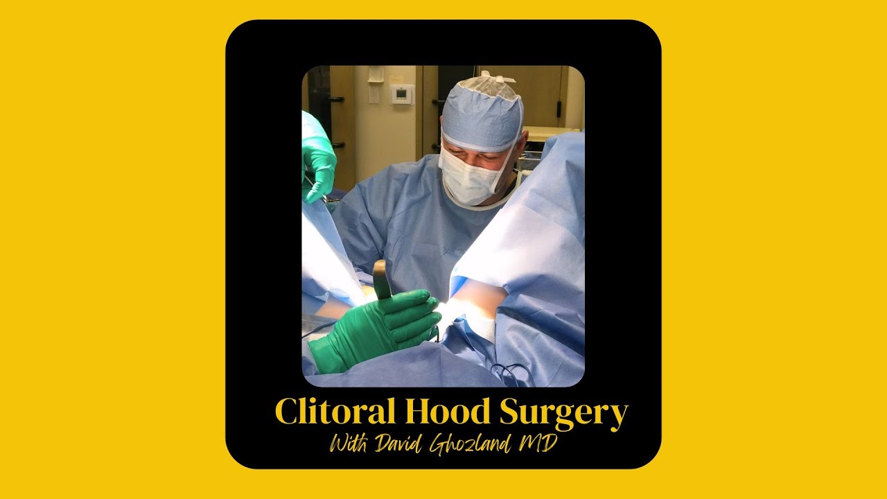 Clitoral Hood Reduction & Lift - YouTube