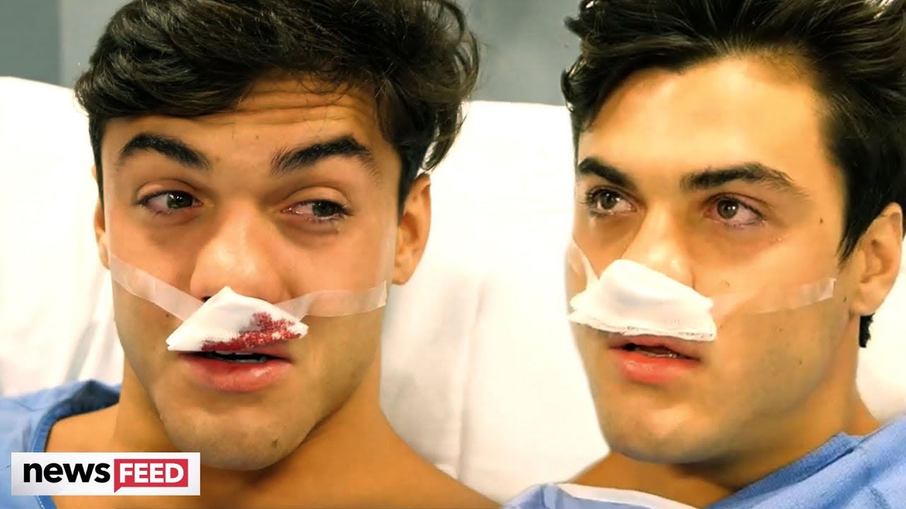 The Dolan Twins Take Laughing Gas & Film The Hysterical Aftermath ...