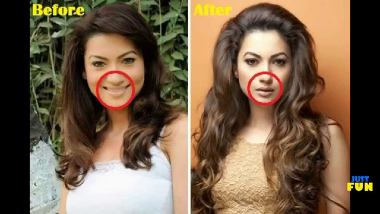 Bollywood Divas And Their Plastic Surgeries | Images Before and After ...