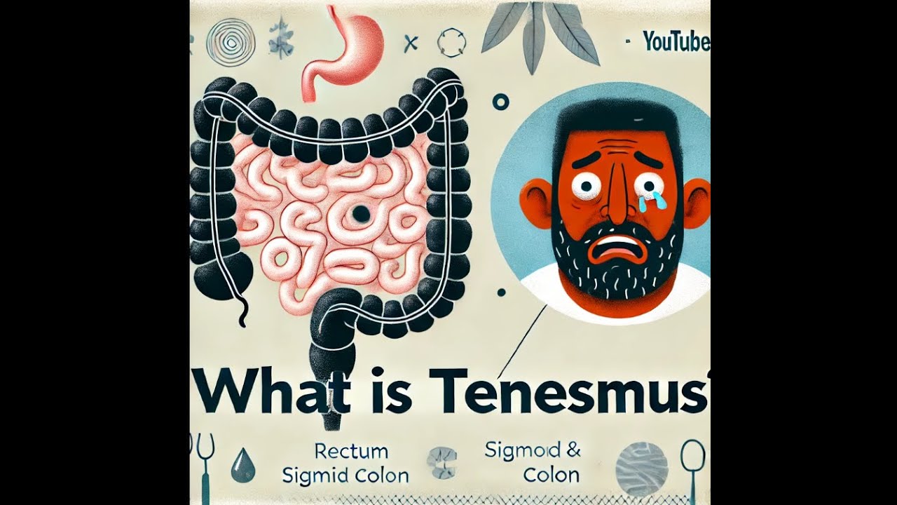 what is tenesmus and why does it occur? - YouTube