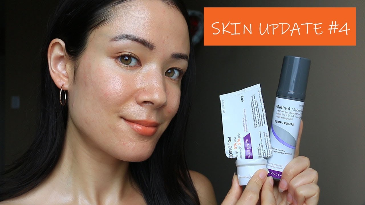 SKIN UPDATE [#4]: Adapalene (Differin) to Tretinoin (Retin-A Micro ...