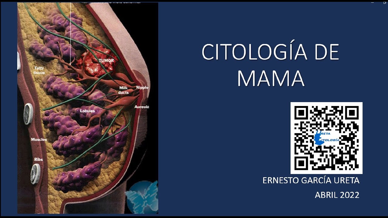 Citología de la Mama - YouTube